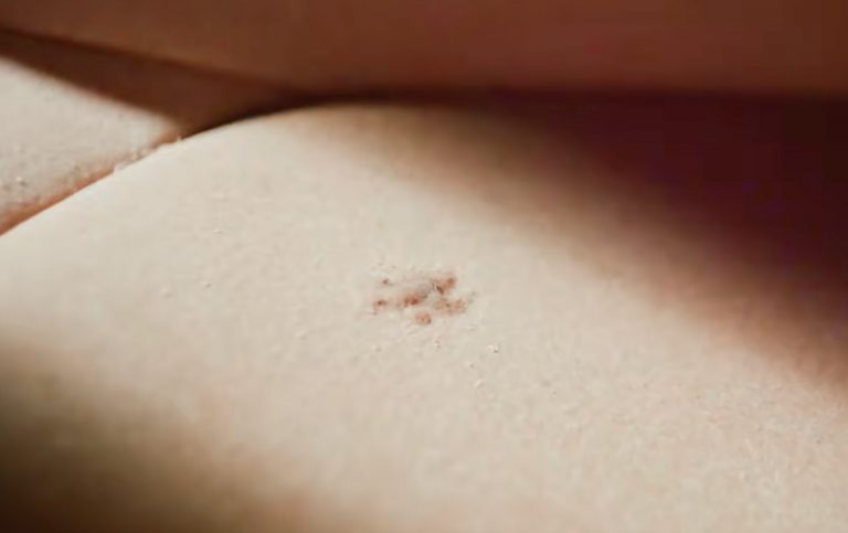 A Car With A Human Skin-Like Interior Complete With Hair And Moles Was ...